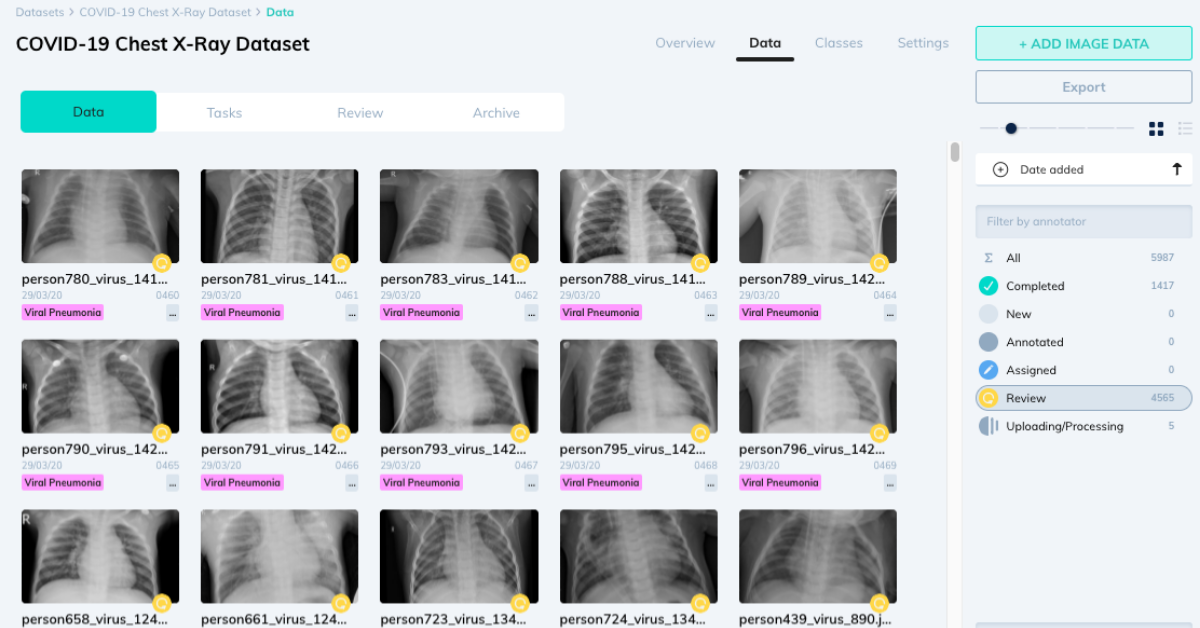 V7 Labs & CloudFactory Release Annotated X-Ray Dataset to Aid in COVID ...